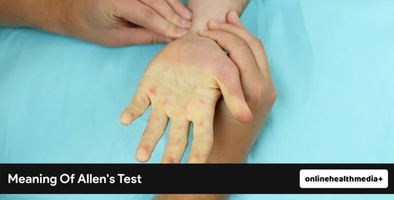Allen's Test - Physical Examination Of Arterial Blood Flow To The Hands