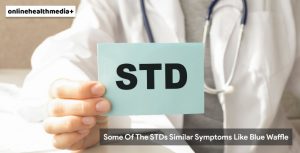 Blue waffle disease: Does It Really Exist? Explanation Of Gynaecologists