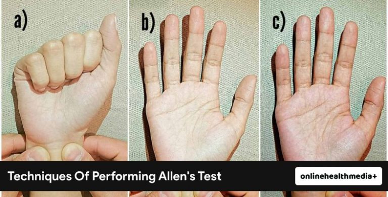 Allen's Test - Physical Examination Of Arterial Blood Flow To The Hands