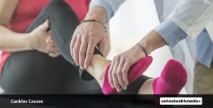 What Are Cankles And How To Get Rid Of Them - All You Need To Know