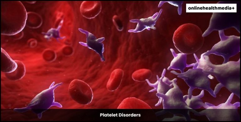 What Are Blood Cell Disorders? Symptoms, Treatment, And Prevention