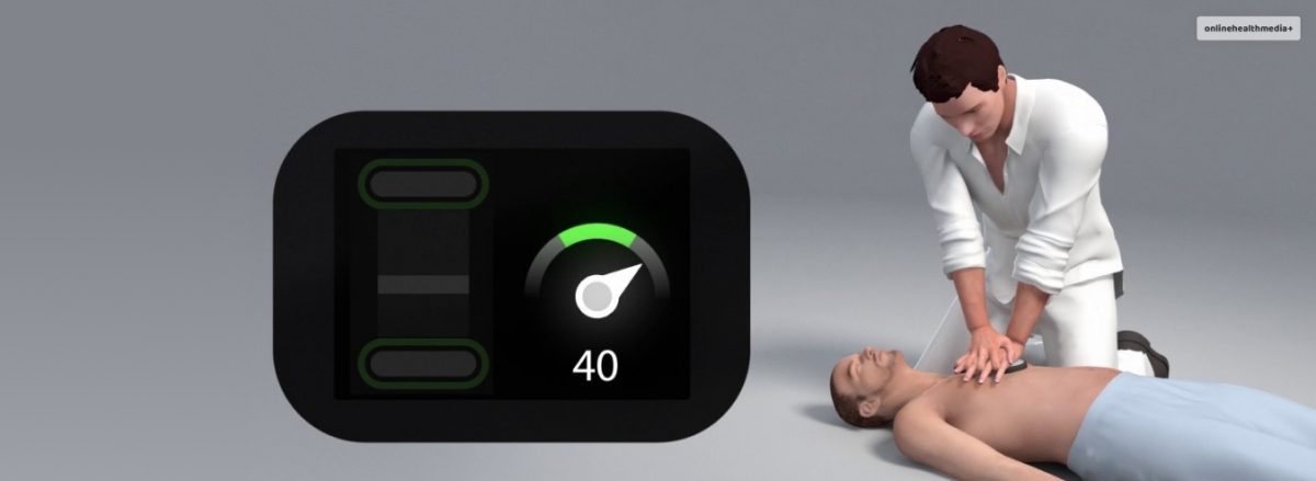 What Does A Chest Compression Feedback Device Monitor Do?