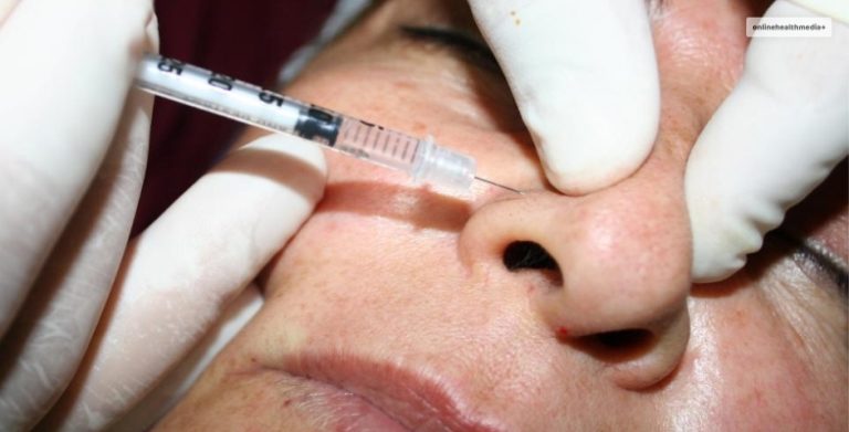 Botox Danger Zones: Facial Zones That You Need To Avoid Injecting!