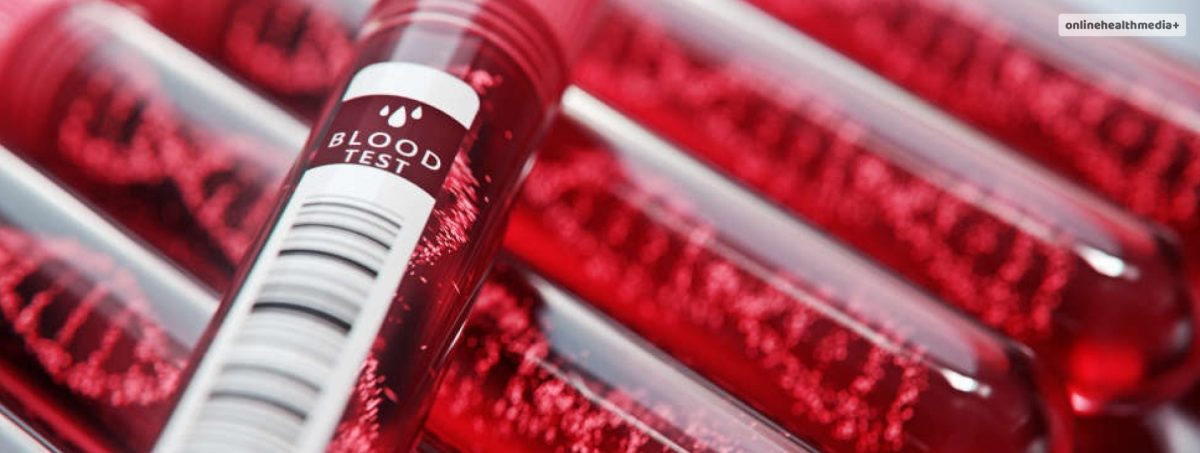 Labcorp Launches Test For Alzheimer's Diagnosis Targeting Biomarkers ...