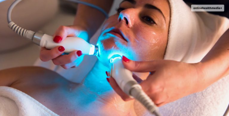 What are the Benefits of IPL Laser Treatments?