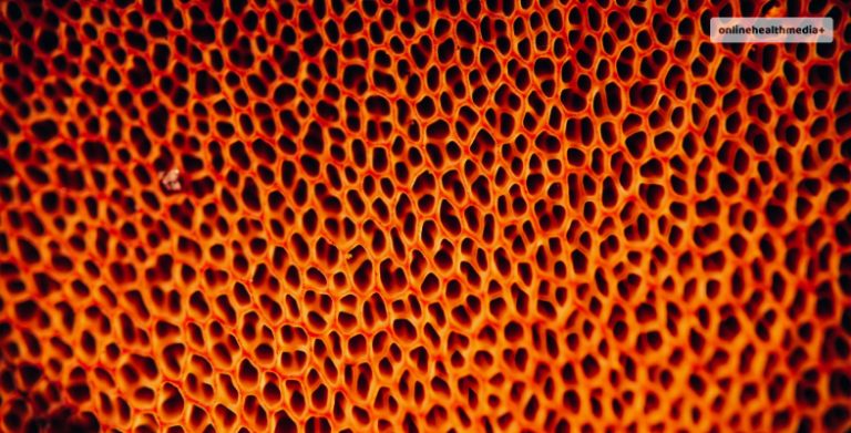Trypophobia Is Not A Big Problem! Here Is How You Can Deal With It